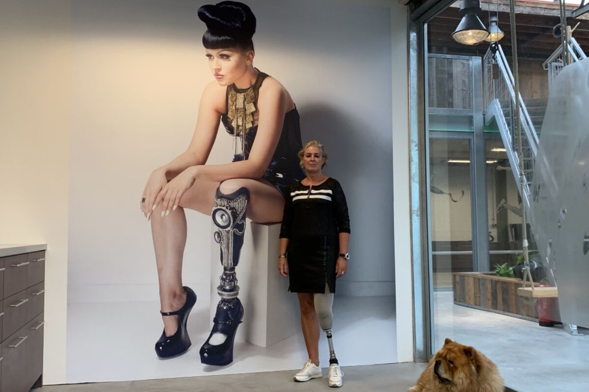 Renee vertelt over haar beenprothese | De Hoogstraat Orthopedietechniek