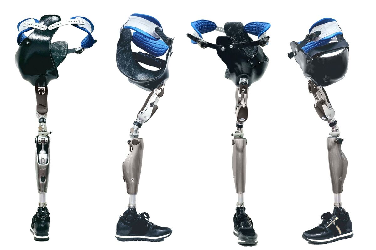 Nieuw type heupprothese: de Bikini Socket